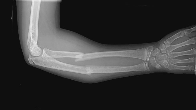 En caso de emergencia (4): lo que podemos hacer - Circula Seguro